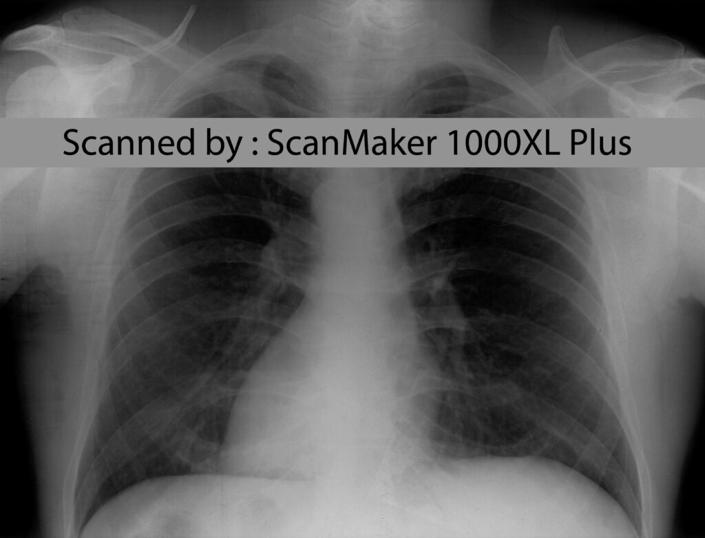 ScanMaker 1000XL Plus A3 plošni foto skener - Skeneri.hr